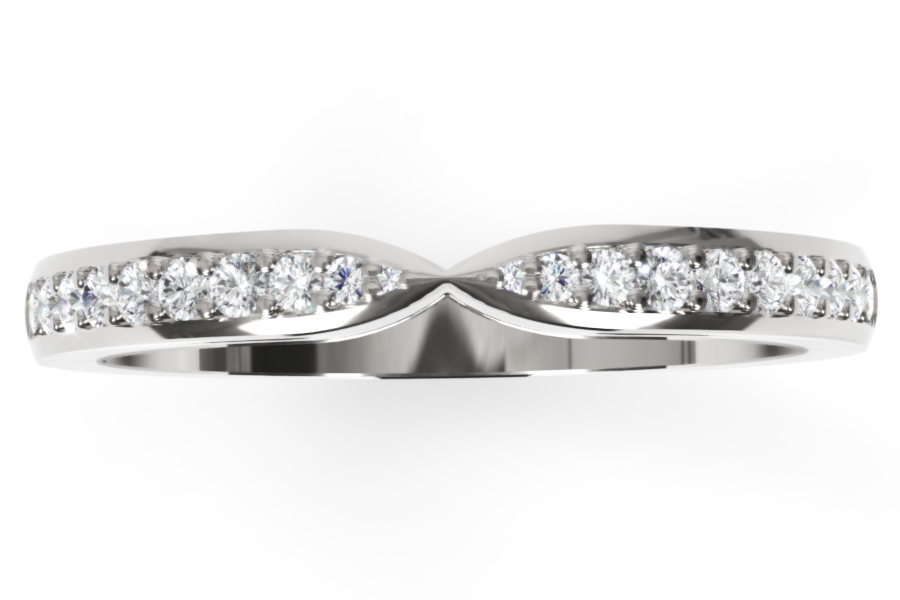 Pinched In Wedding Ring